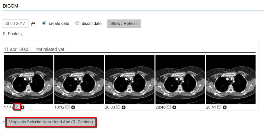 How do I link a DICOM image to a patient file? – Animana help hub